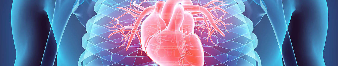 IVC Filters | Product Liability Lawyer | Frank Azar Car & Truck ...